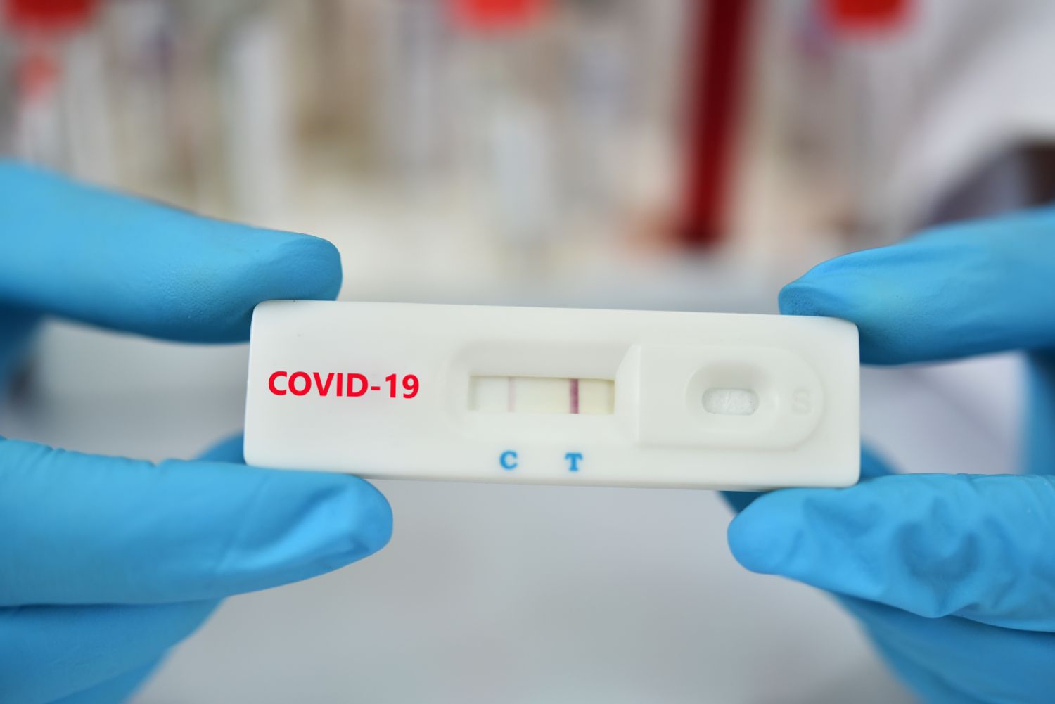 Kit test nhanh Covid-19: Mua loại nào, ở đâu đảm bảo?