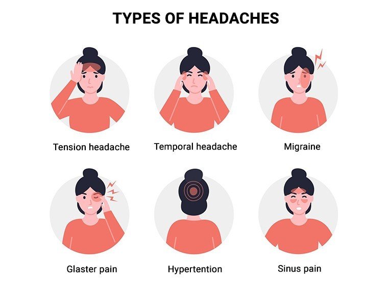 Nhiều người đối mặt cơn đau đầu - đau nửa đầu Migraine nhưng không hiểu tường tận về bệnh