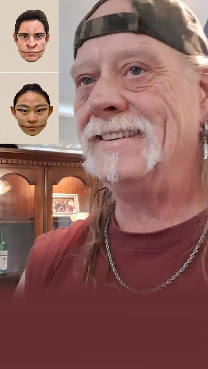 Trải lòng của người mắc hội chứng “nhìn người hóa quỷ”