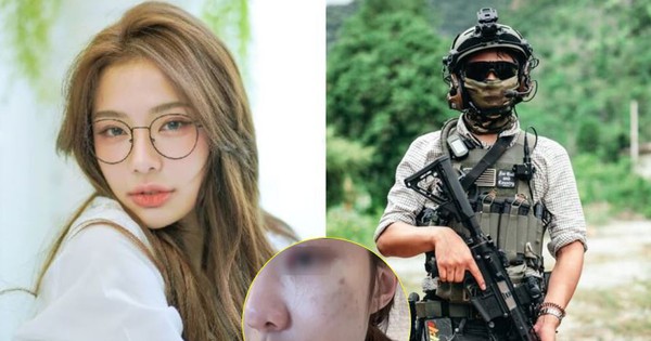 Nữ ca sĩ Thái Lan Gigi Supitcha vừa qua đời ở tuổi 20 từng bị bạn trai bạo hành nghiêm trọng